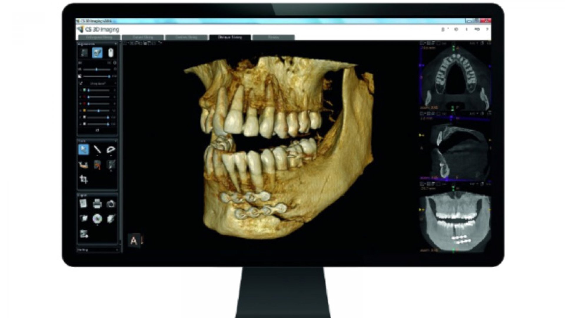 3D-CT und Panorama-Röntgenaufnahmen | KG Zahnmedizin